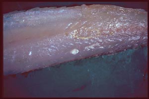 Larvae of other tapeworms of Tetrarhynchoidea ｜Bureau of Public Health ...